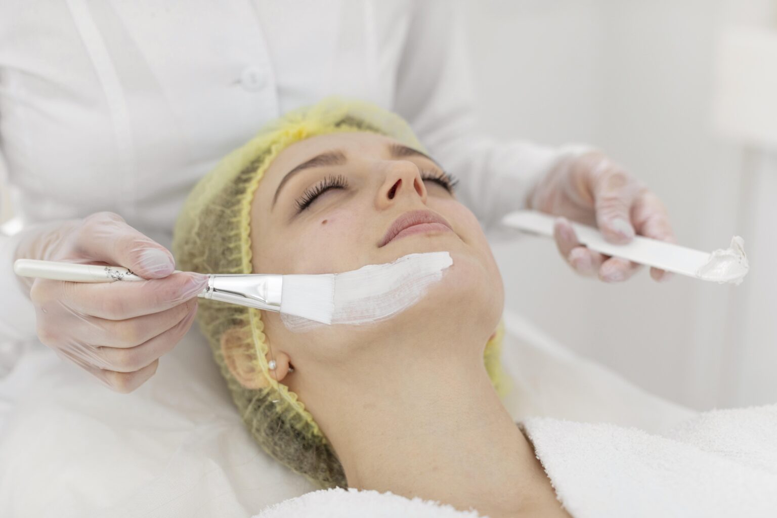 PEELING QUÍMICO - Clínica Ideal